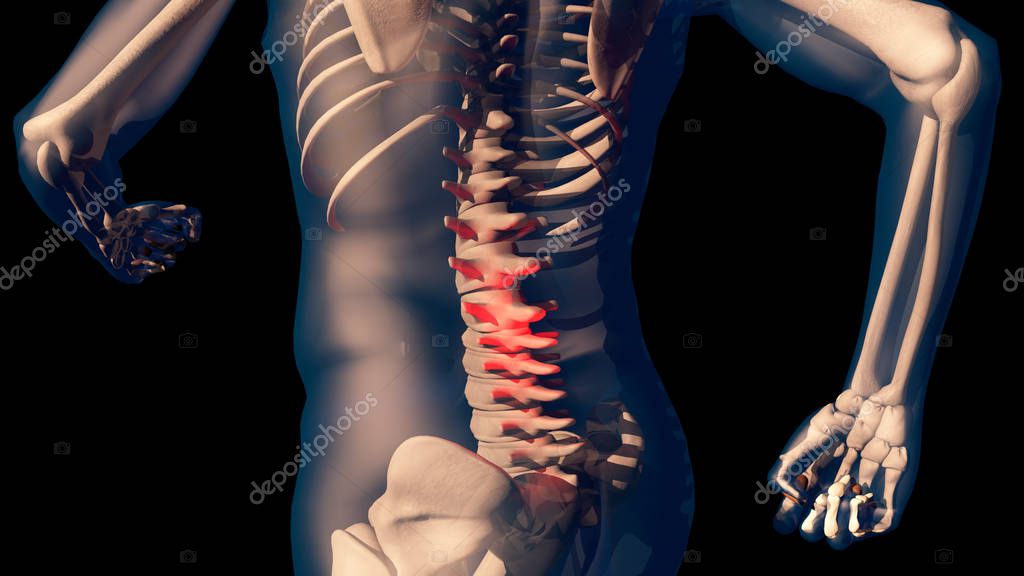 Fotos de Dolor en la columna vertebral inferior en el diseño ...