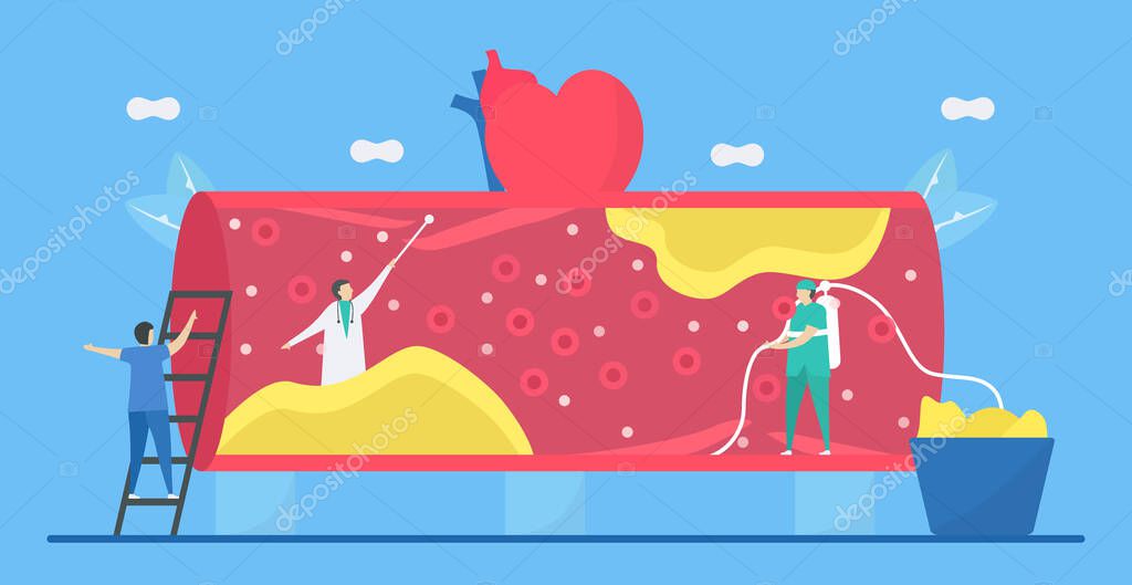 Ilustración Del Vector Cardiológico La Aterosclerosis Es Una