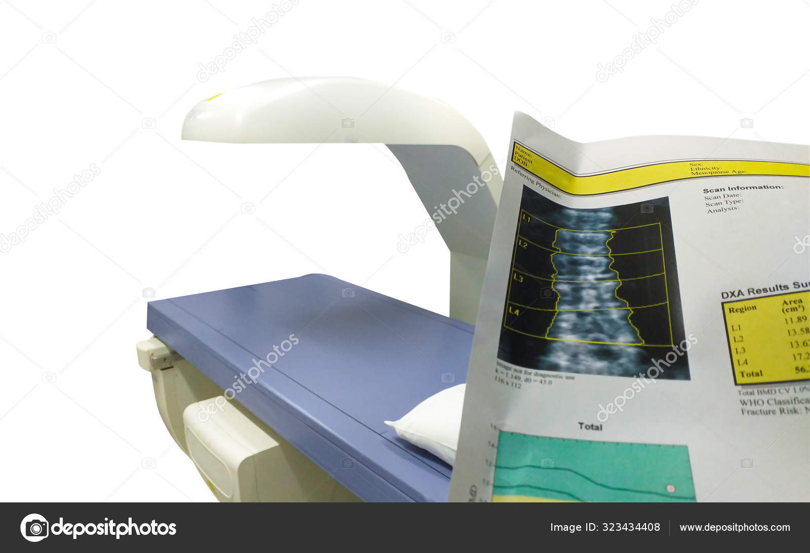 Special examination lumbar spine bone density. — Stock Photo ...