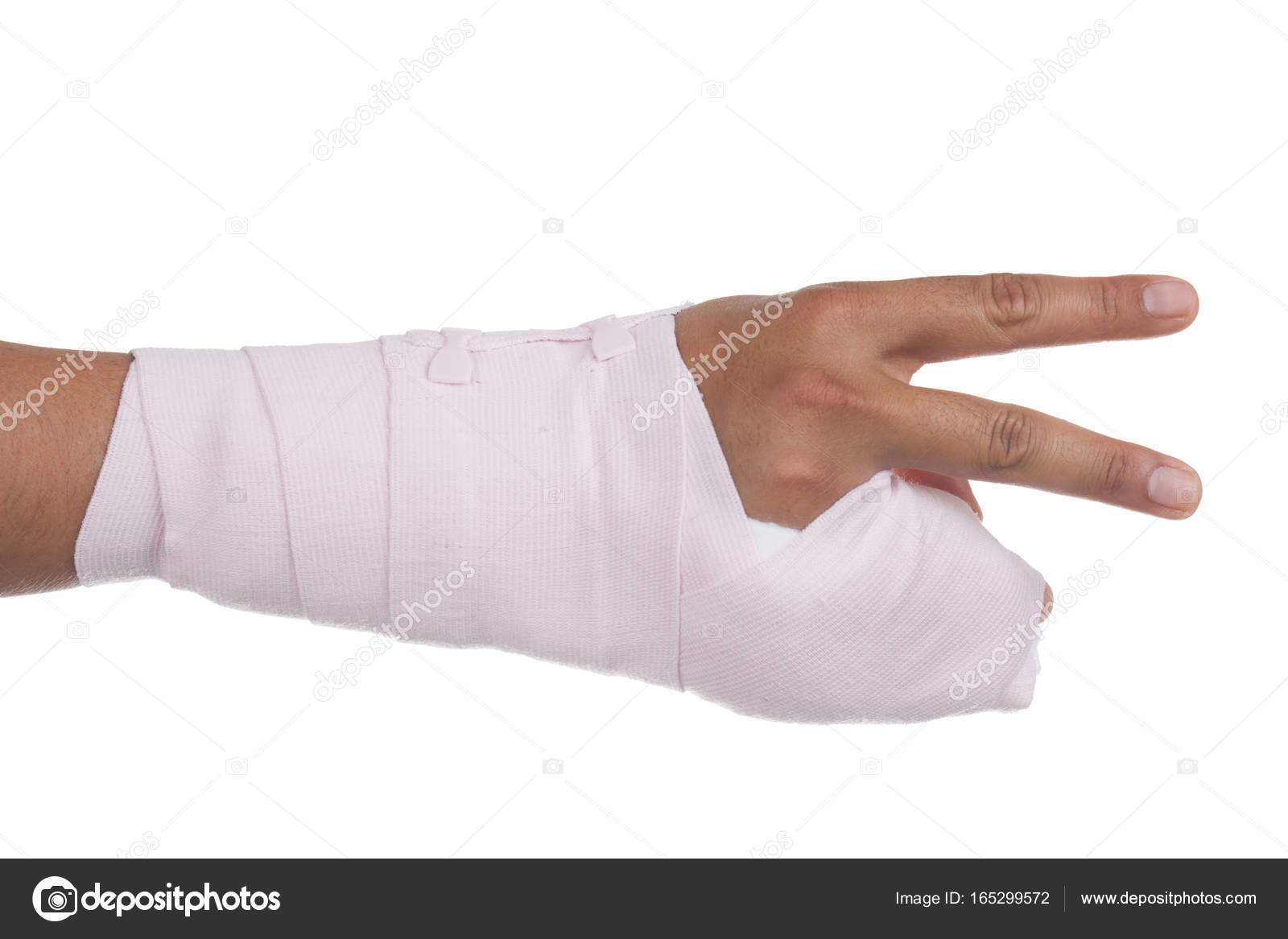 Smashed Hand Injury