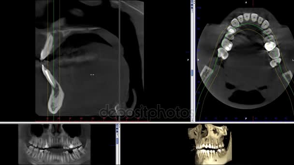 Real life MRI scan of man jaws for stomatology dentist research new ...
