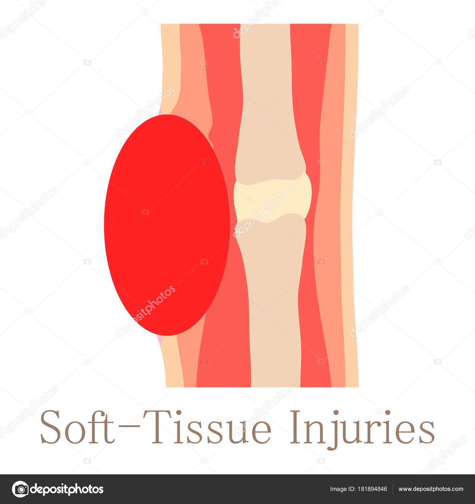 Soft tissue injury icon, cartoon style Stock Vector Image by ...