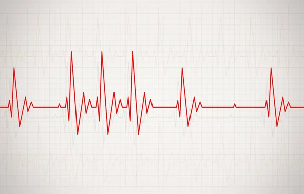 Fast heart beat Stock Photos, Royalty Free Fast heart beat Images ...