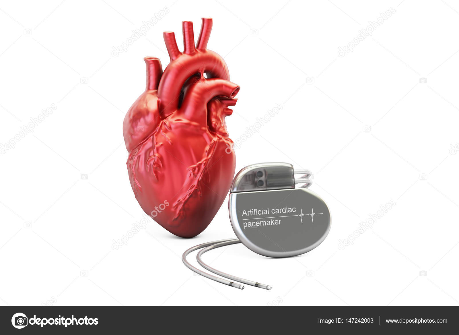 Artificial cardiac pacemaker, 3D rendering — Stock Photo © alexlmx ...