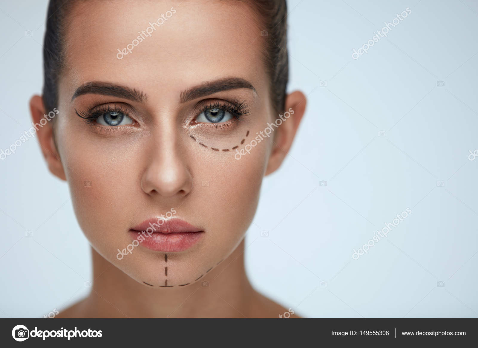 Plastic Surgery Operation. Woman Face With Black Surgical Lines Stock ...