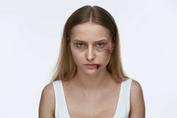 Domestic Violence. Woman With Beating On Face Stock Photo by ©puhhha ...