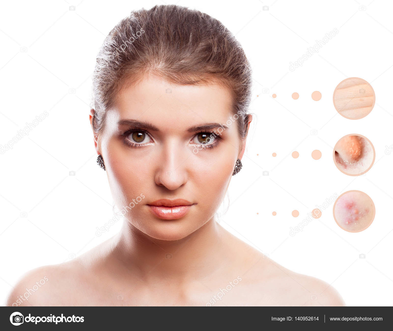 Skin problem of woman face Stock Photo by ©orelphoto2 140952614