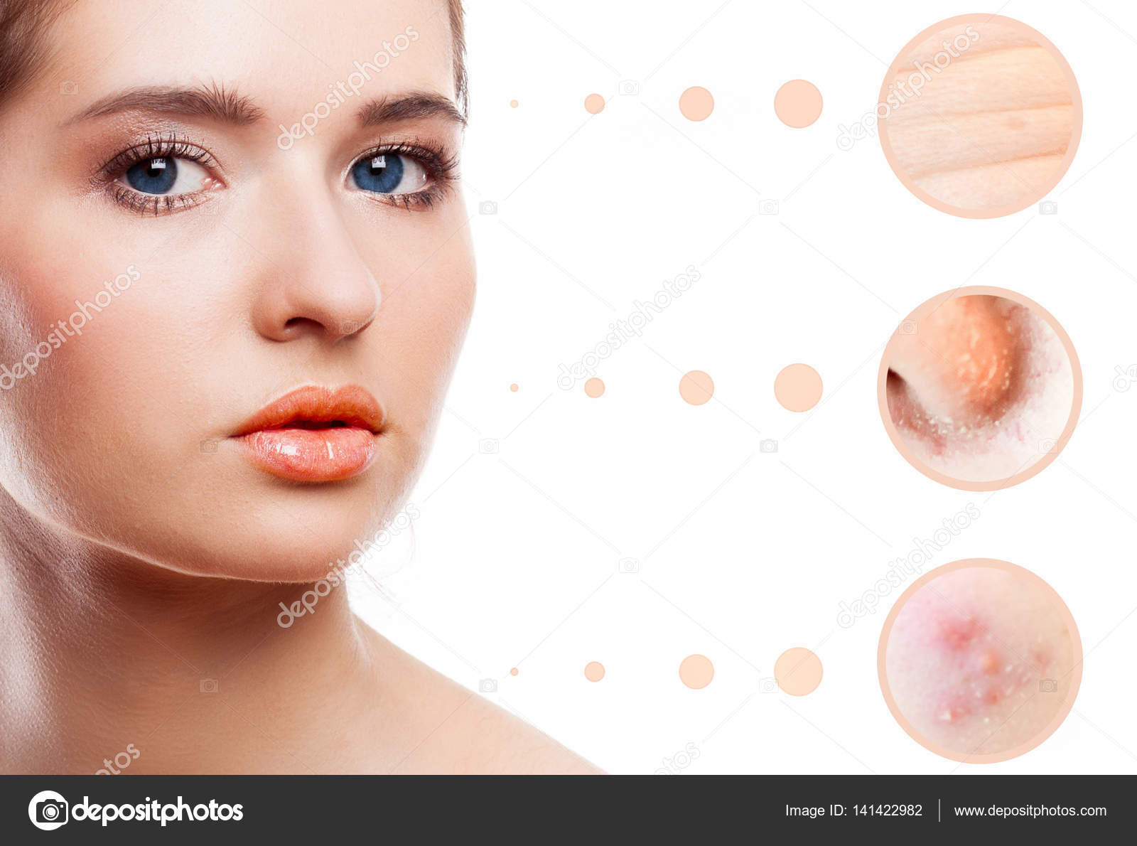 Skin problem of woman face Stock Photo by ©orelphoto2 141422982 Skin problem of woman face Stock Photo by ©orelphoto2 141422982
