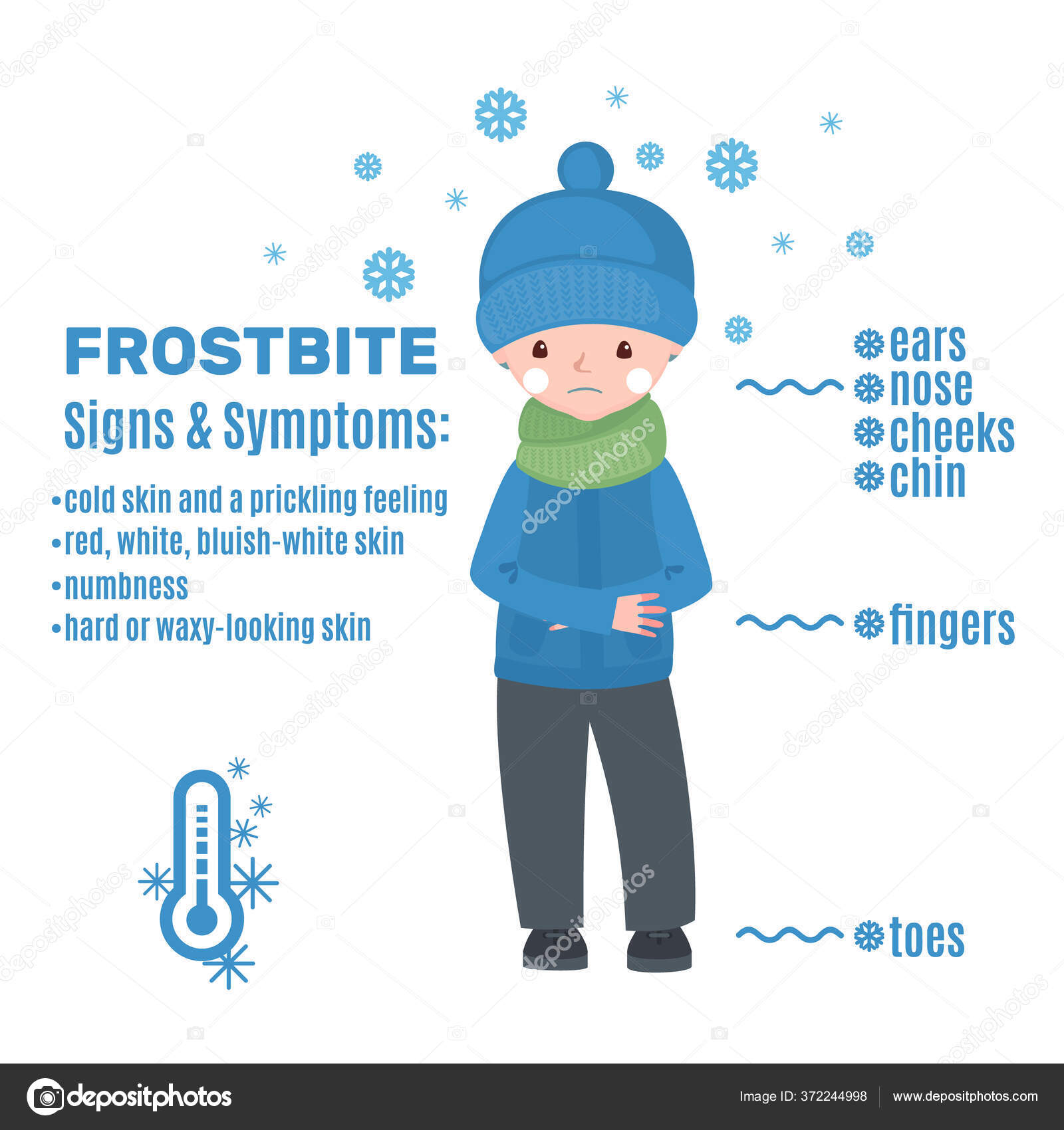 Frostbite Infographic Cartoon Style Isolated White Background Vector ...