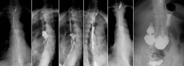 ᐈ Appendix stock images, Royalty Free appendix photos | download on ...