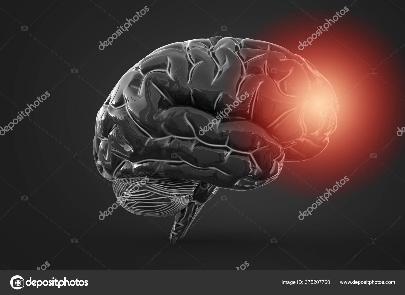 Brain Inflammation Other Process Associated Tissues Damage Thinking ...