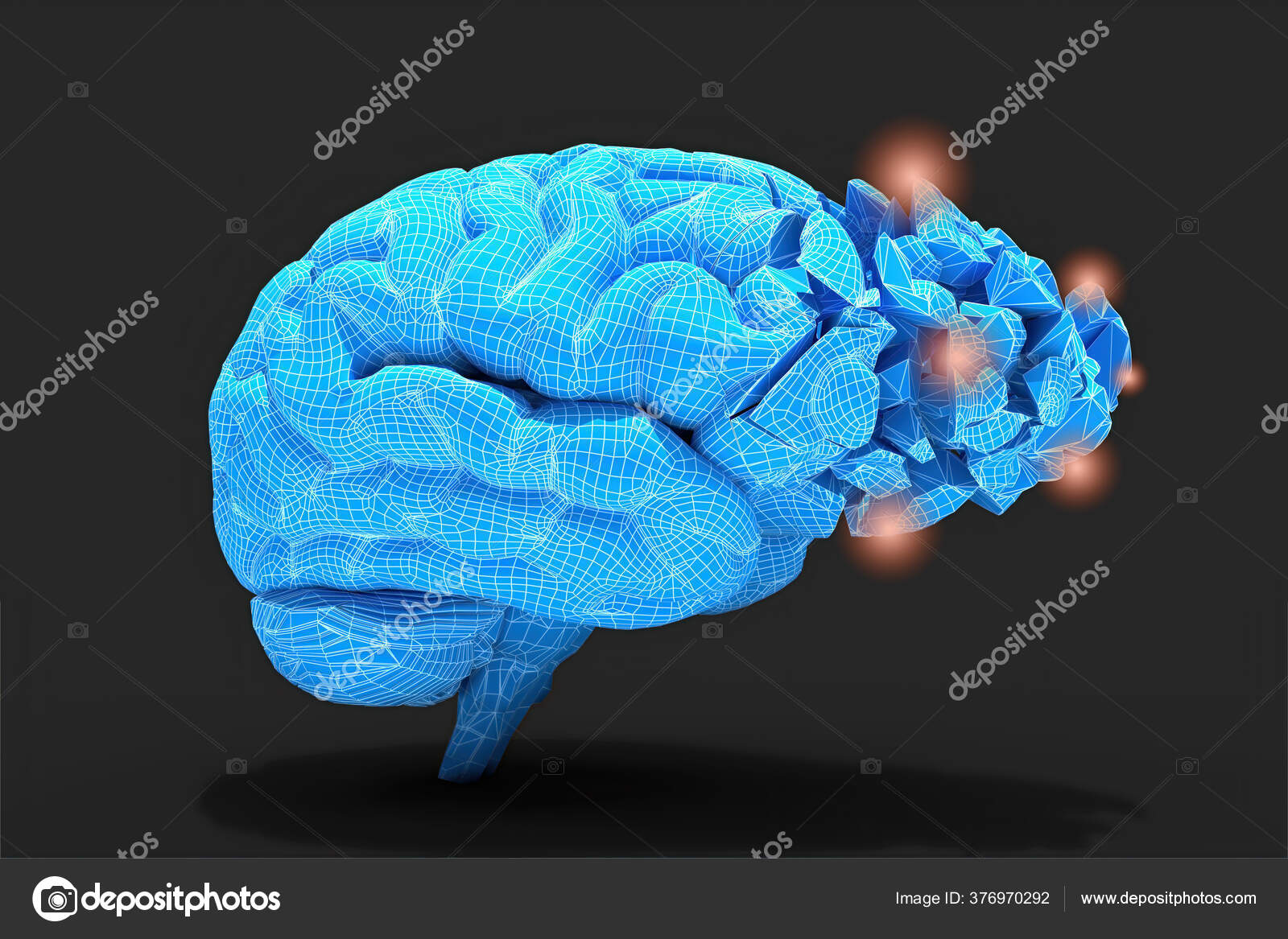 Brain Inflammation Other Process Associated Tissues Damage Thinking ...