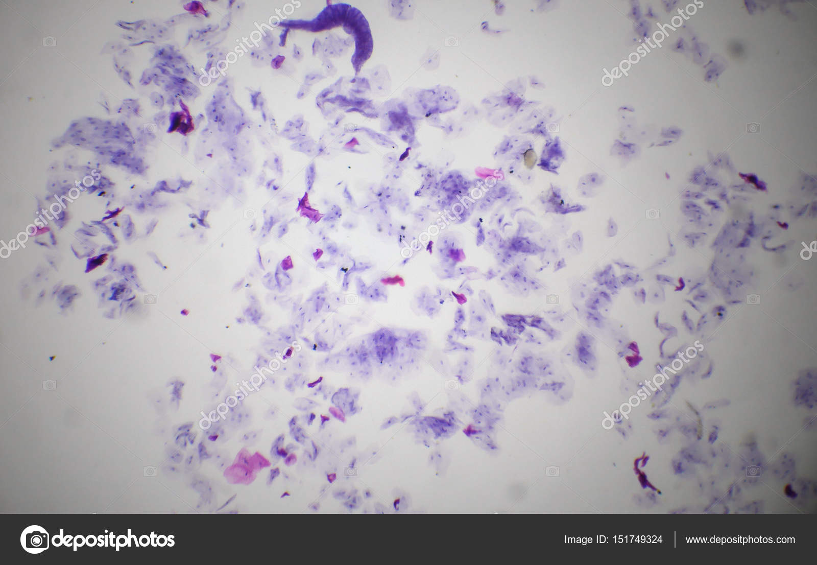 Oral cavity mucous membrane under the microscope Stock Photo by ...