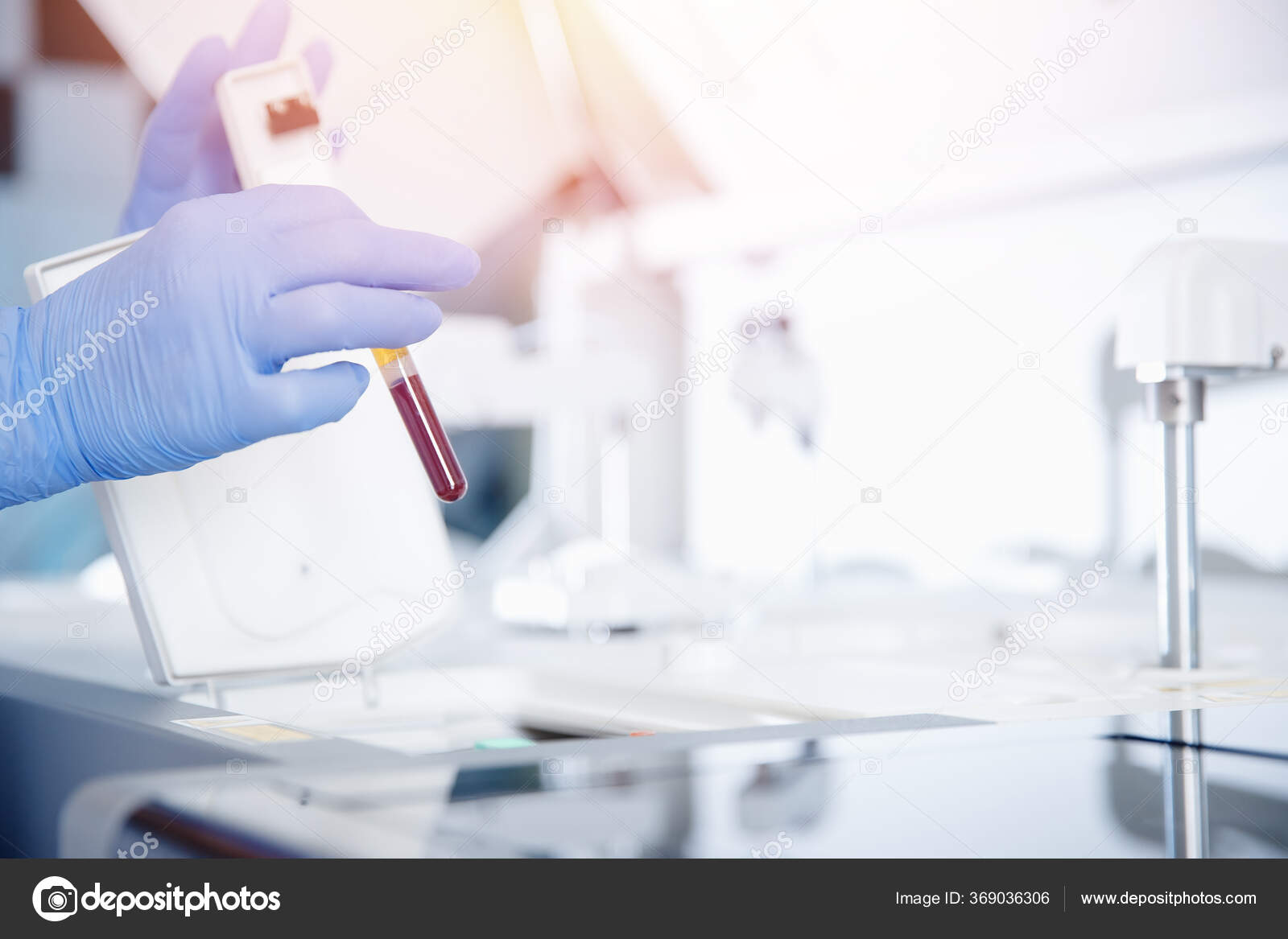 Nurse microbiologist holding test tube with blood for coronavirus 2019 ...