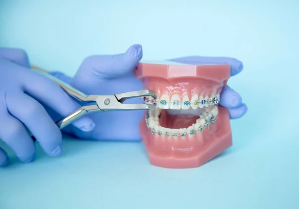 Metal braces for teeth and tools for correction of brace systems ...