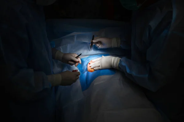 Breast Tumor Resection Plastic Surgery Stock Photo by ©fly_wish 360353446