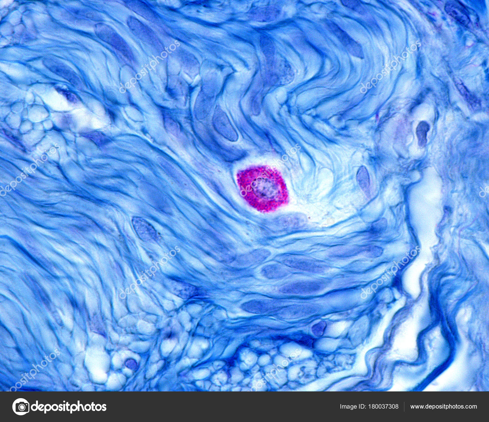 Mast cell — Stock Photo © jlcalvo@ucm.es #180037308