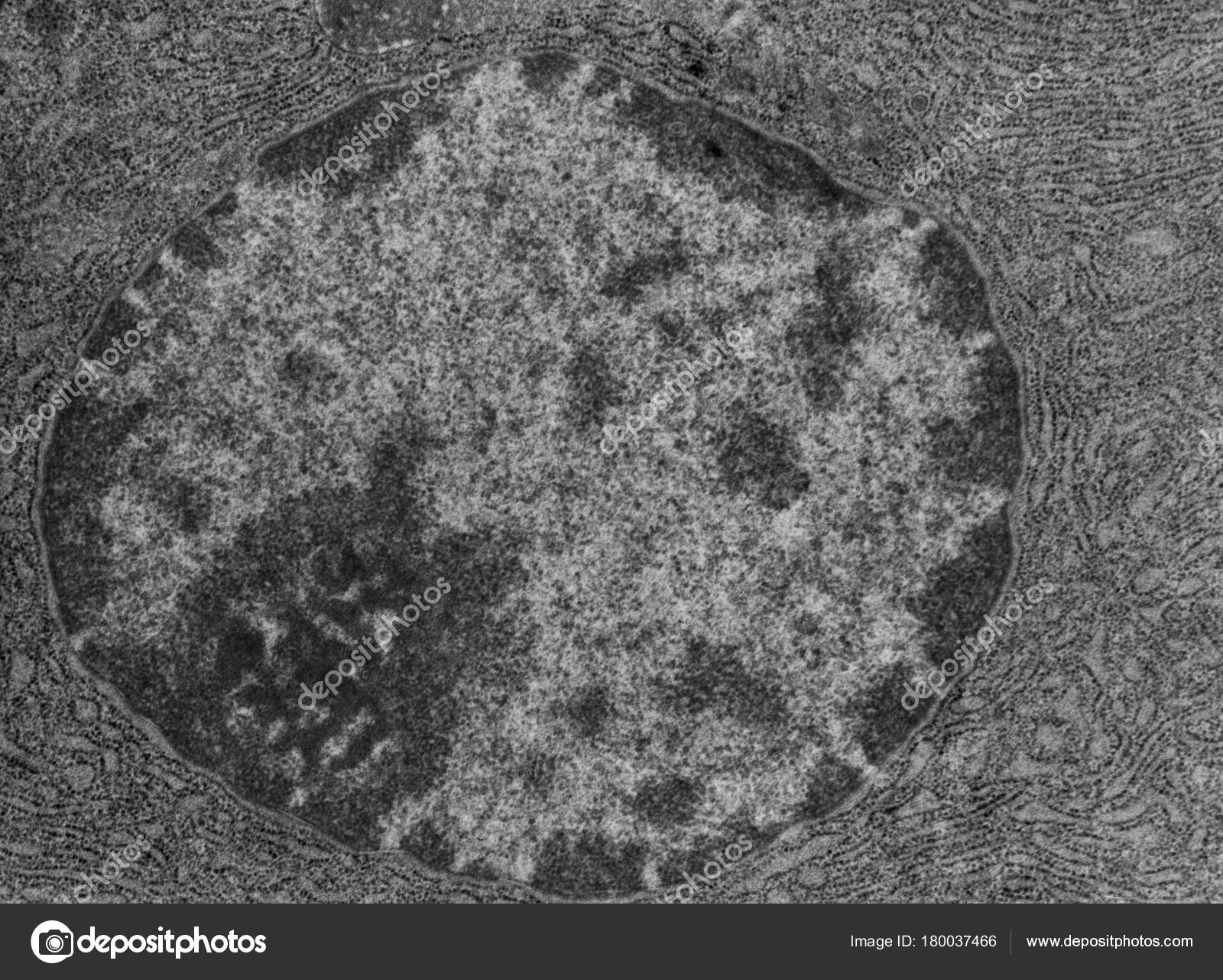 Micrografia Eletronica Do Nucleo