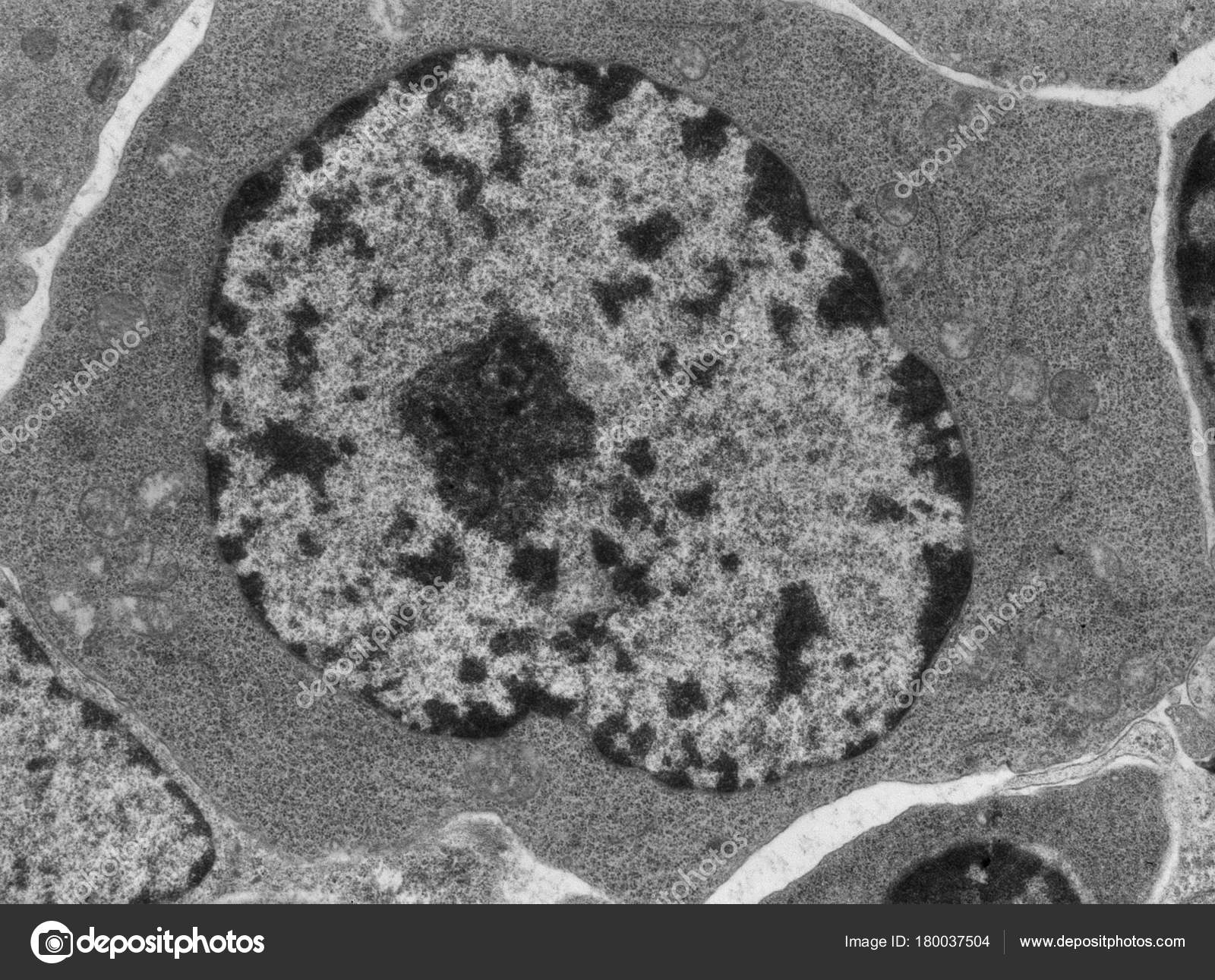 Ribosomes Electron Micrograph