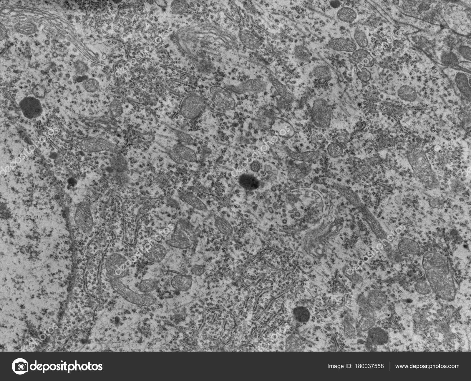 Neuron Electron Microscope
