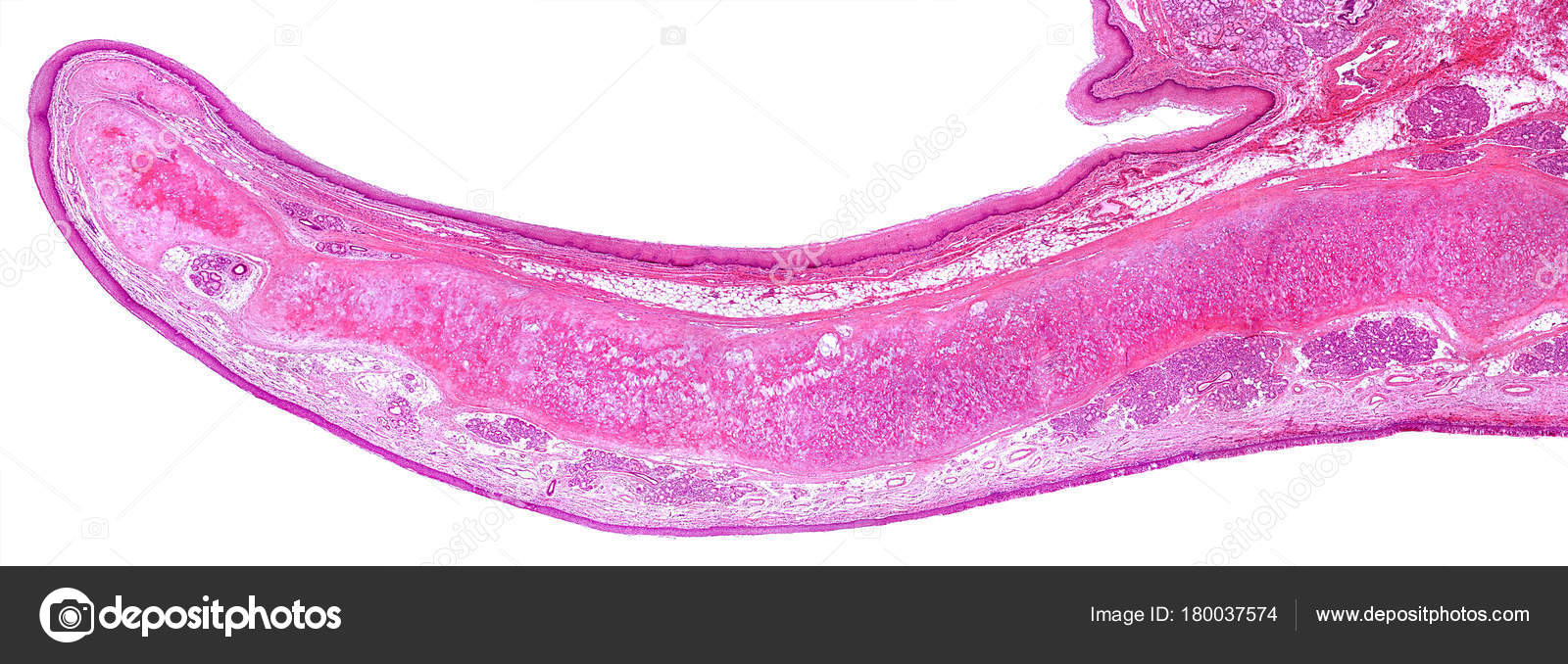 Human epiglottis — Stock Photo © jlcalvo@ucm.es #180037574