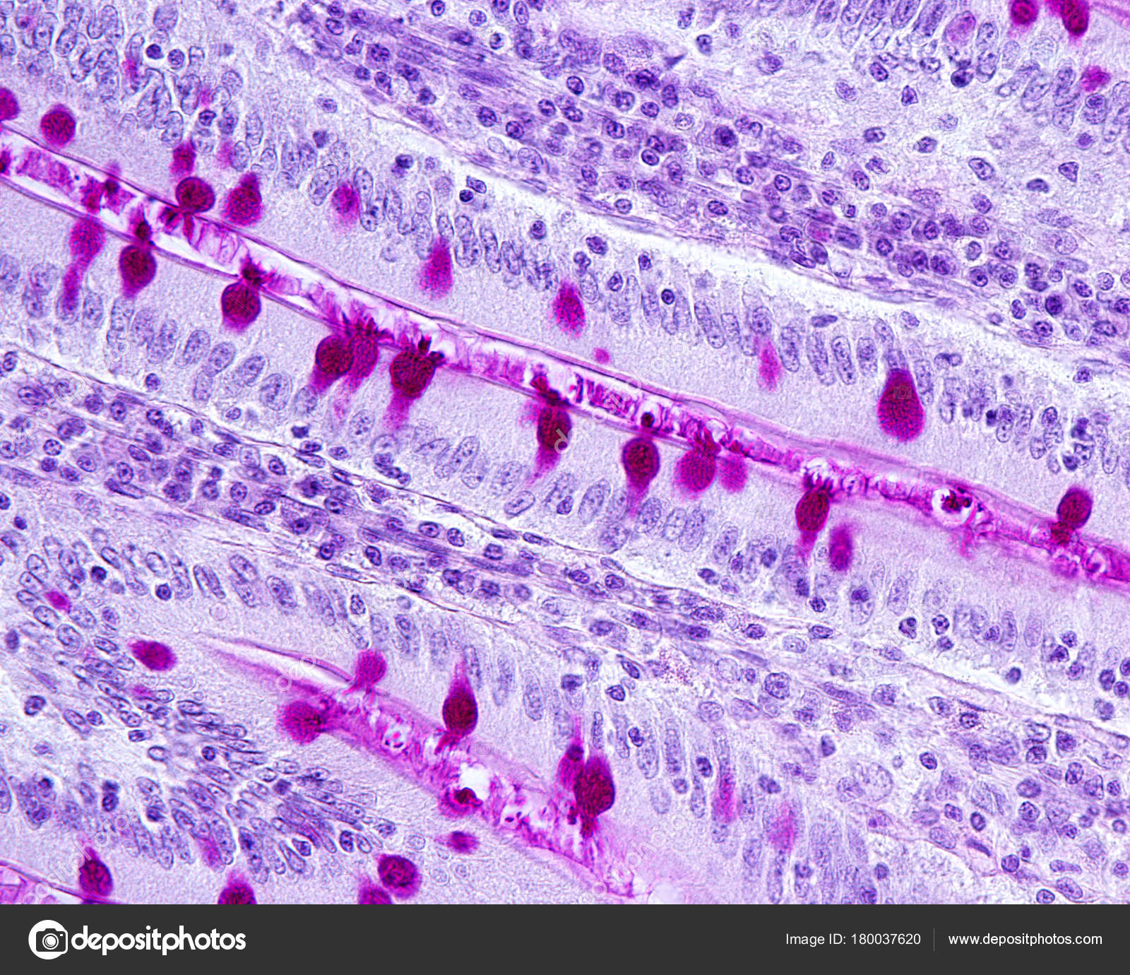 Columnar Epithelium With Goblet Cells