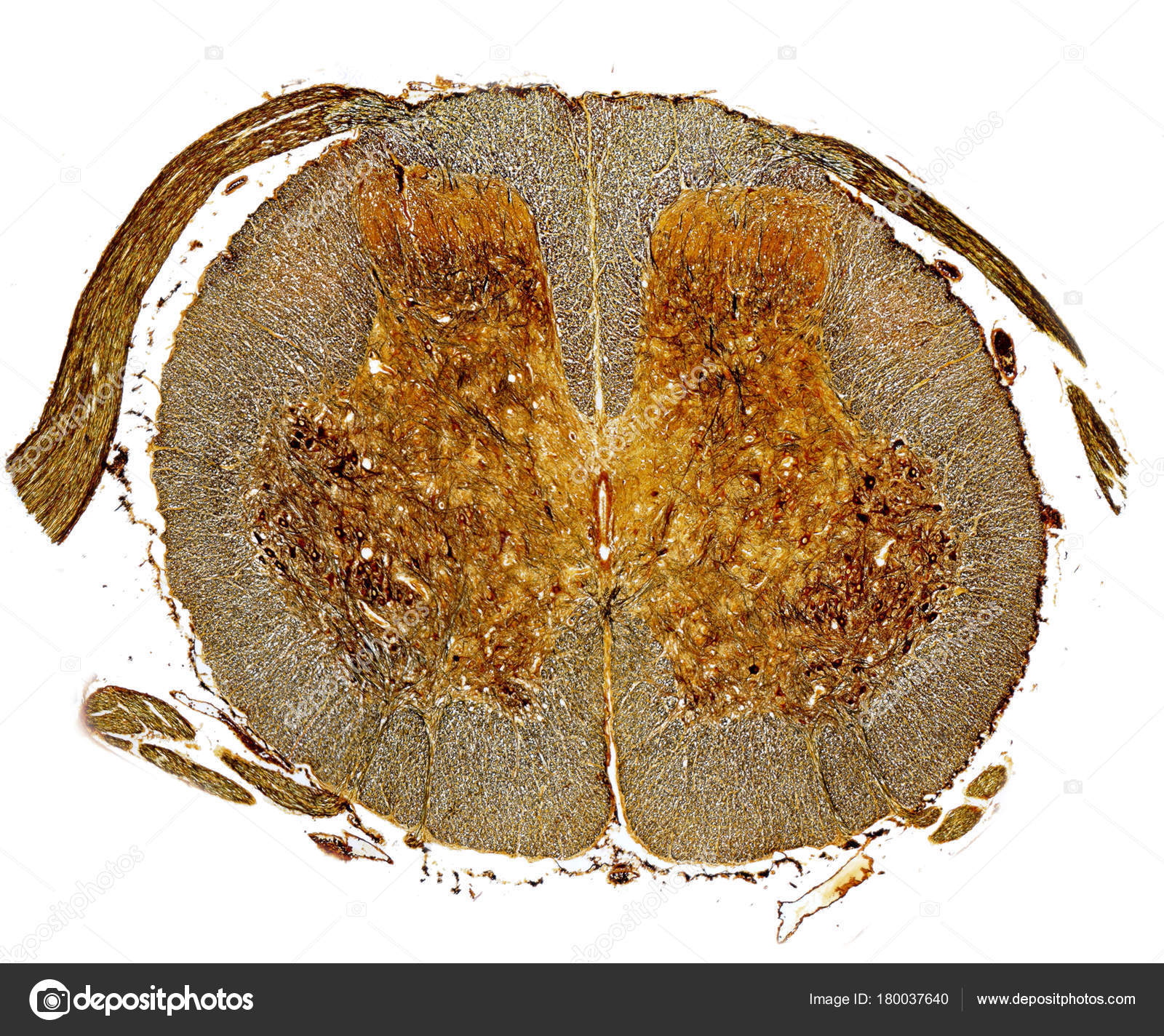 Spinal cord. Silver stain Stock Photo by ©jlcalvo@ucm.es 180037640