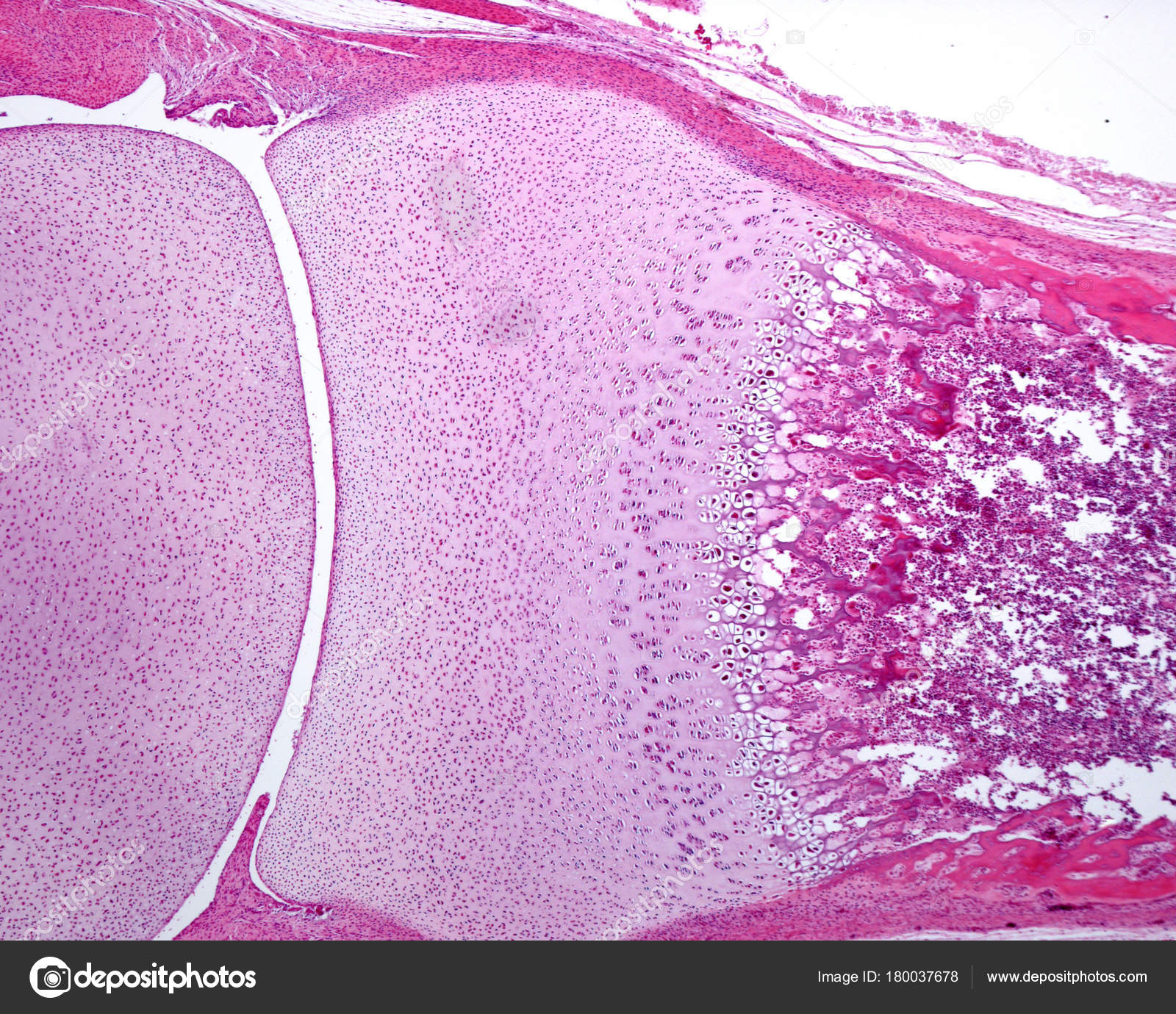 Bone joint ⬇ Stock Photo, Image by © jlcalvo@ucm.es #180037678