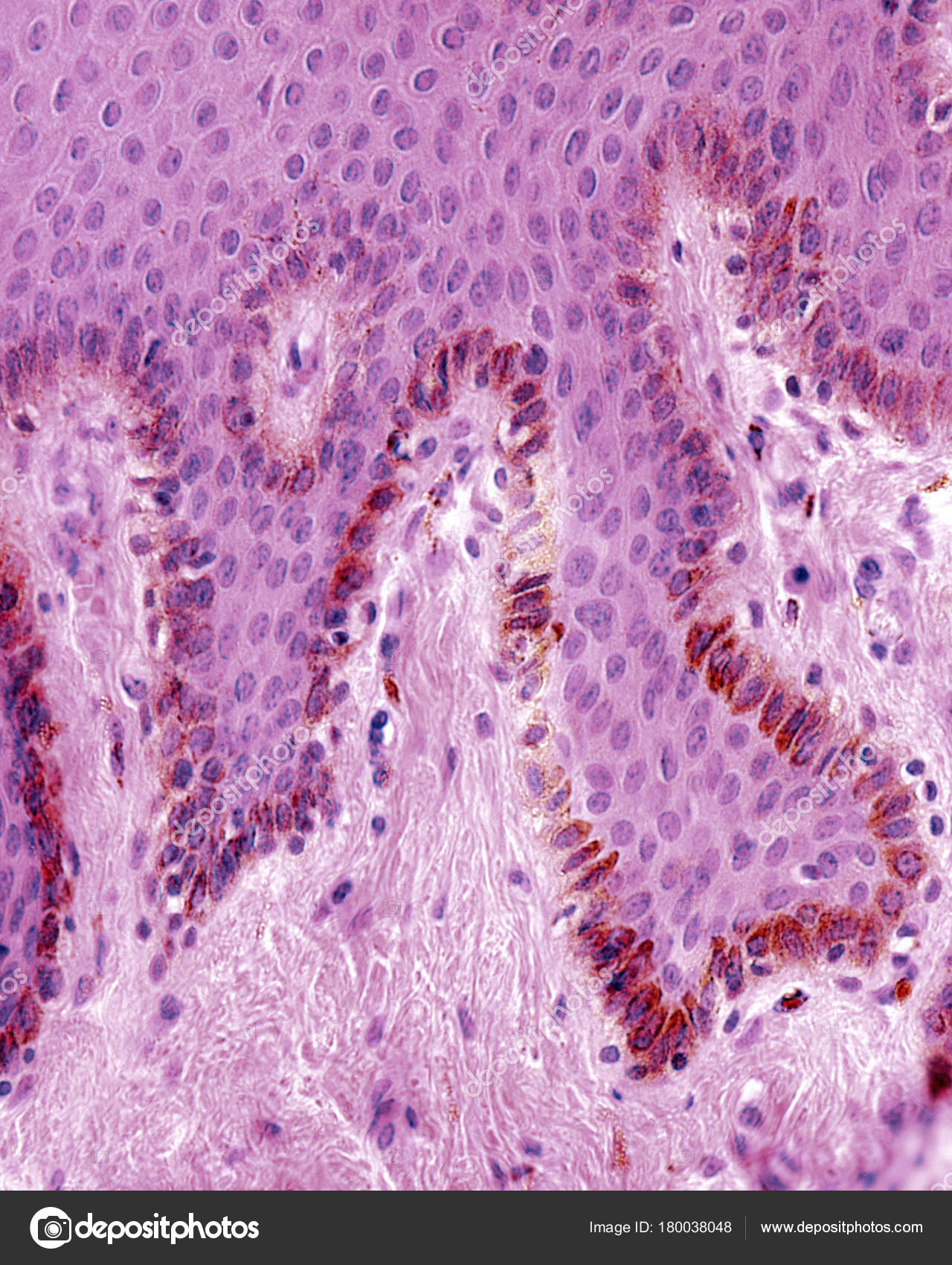 Melanocitos. Epidermis — Foto de stock #180038048 © jlcalvo@ucm.es