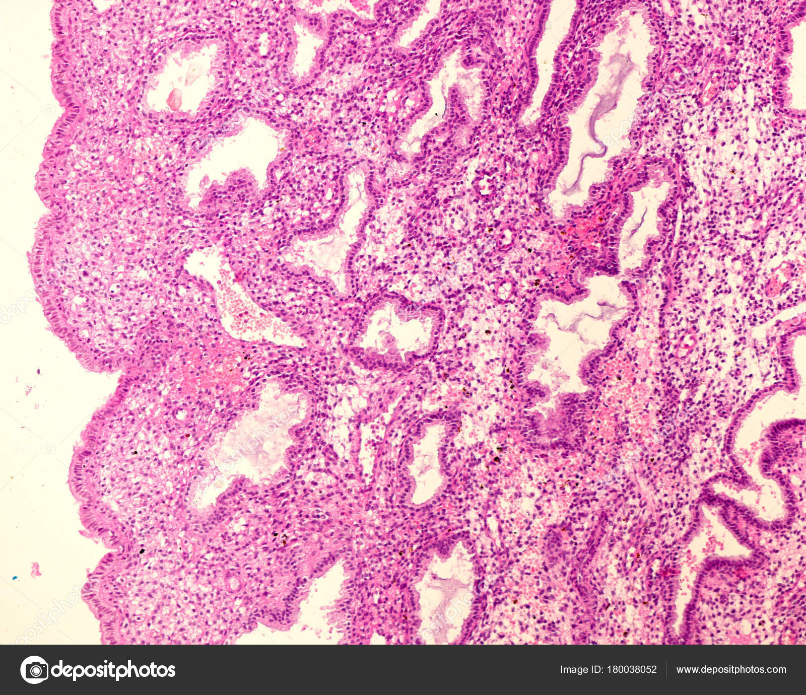 Endometrium Adalah