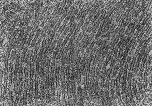 Rough endoplasmic reticulum Stock Photos, Royalty Free Rough ... Rough endoplasmic reticulum Stock Photos, Royalty Free Rough ...
