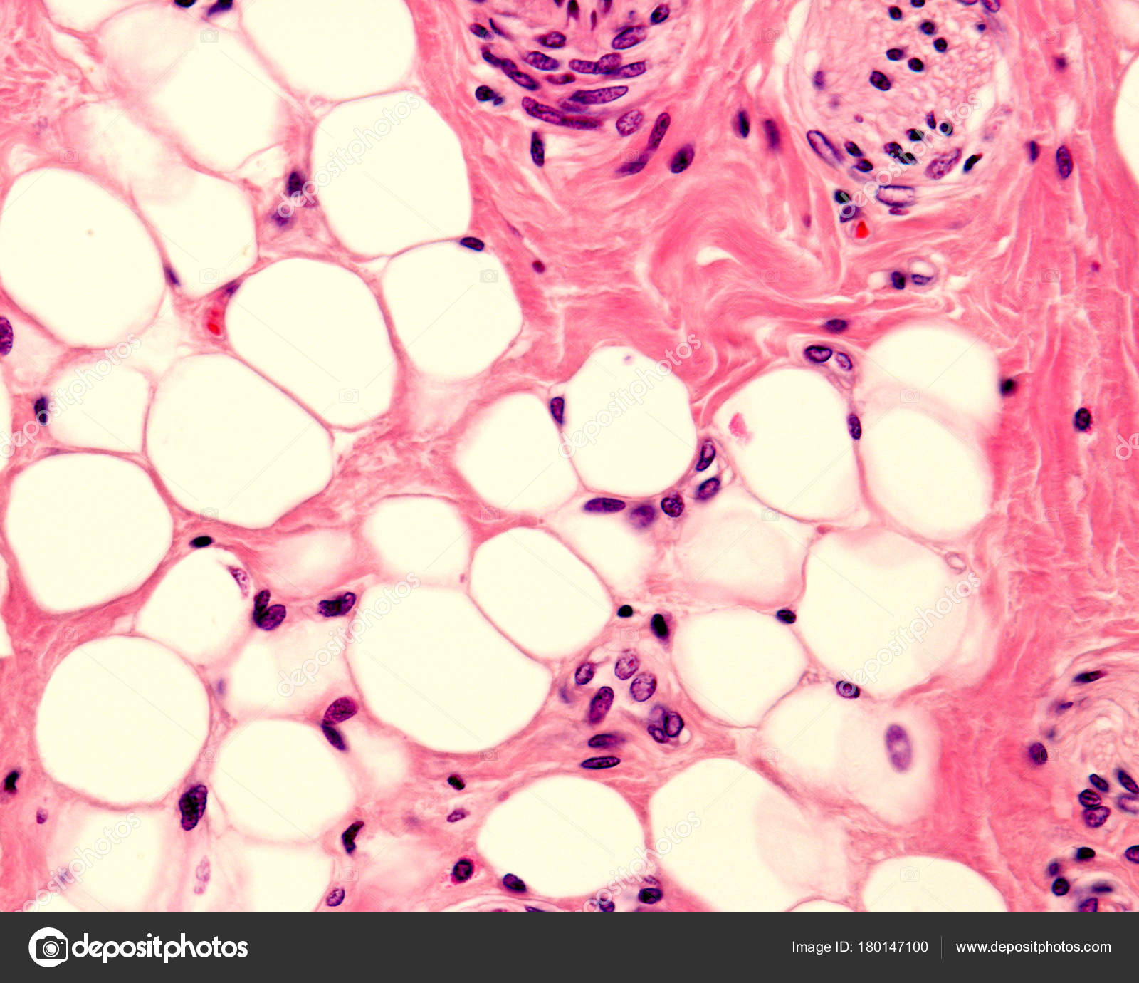 Tejido adiposo — Foto de stock #180147100 © jlcalvo@ucm.es