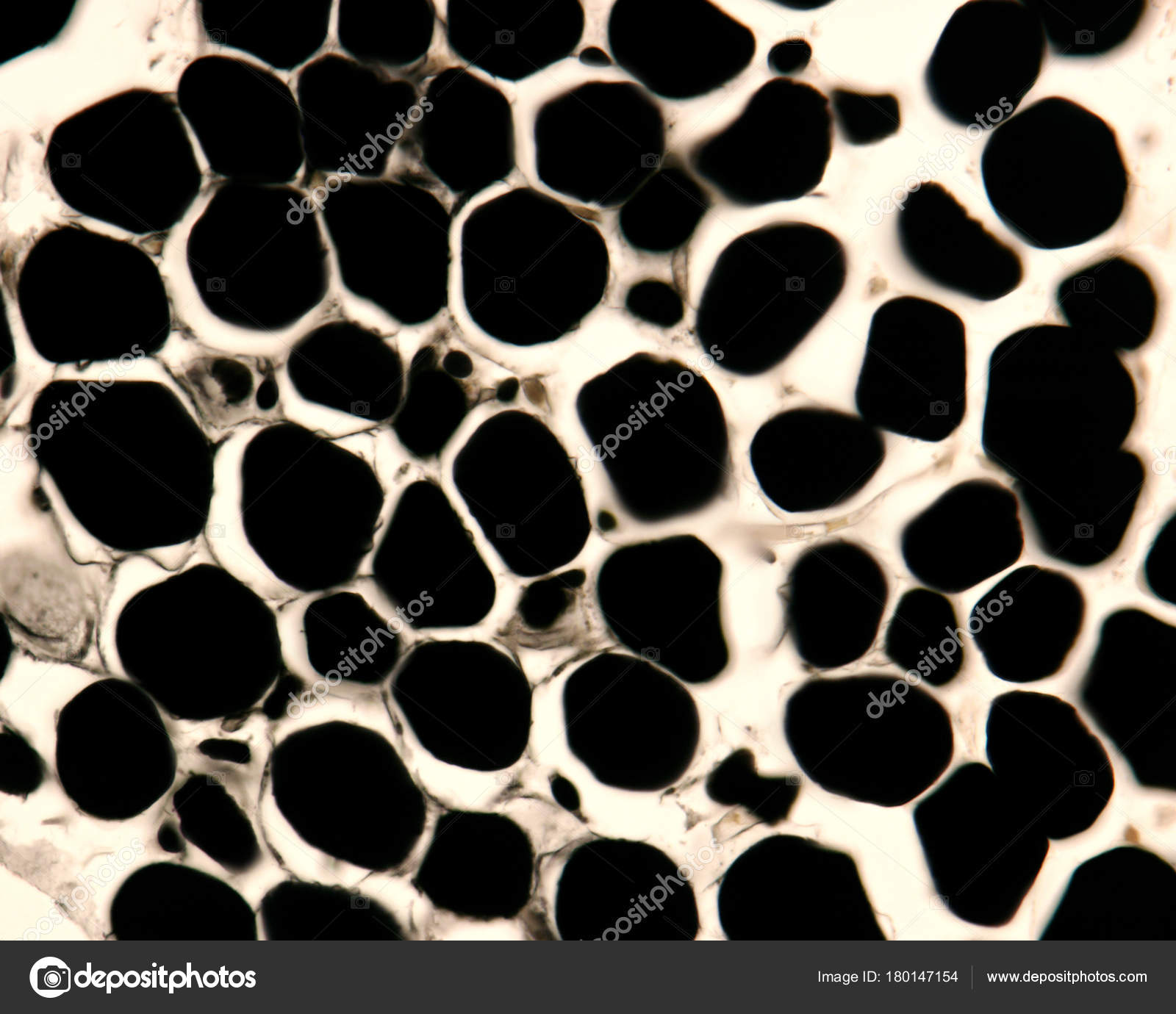 Osmium Tetroxide Stain