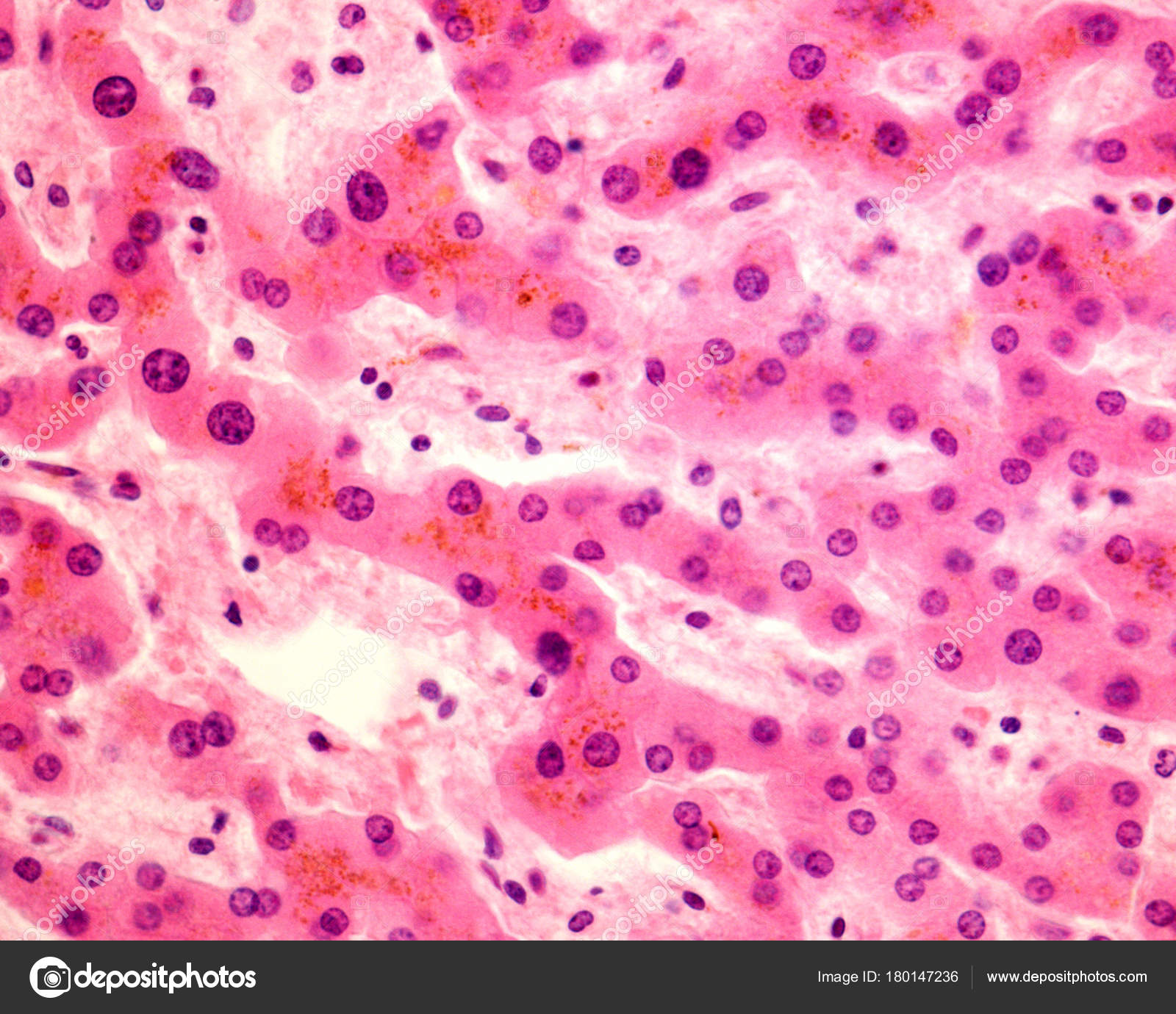 Hepatocytes — Stock Photo © jlcalvo@ucm.es #180147236
