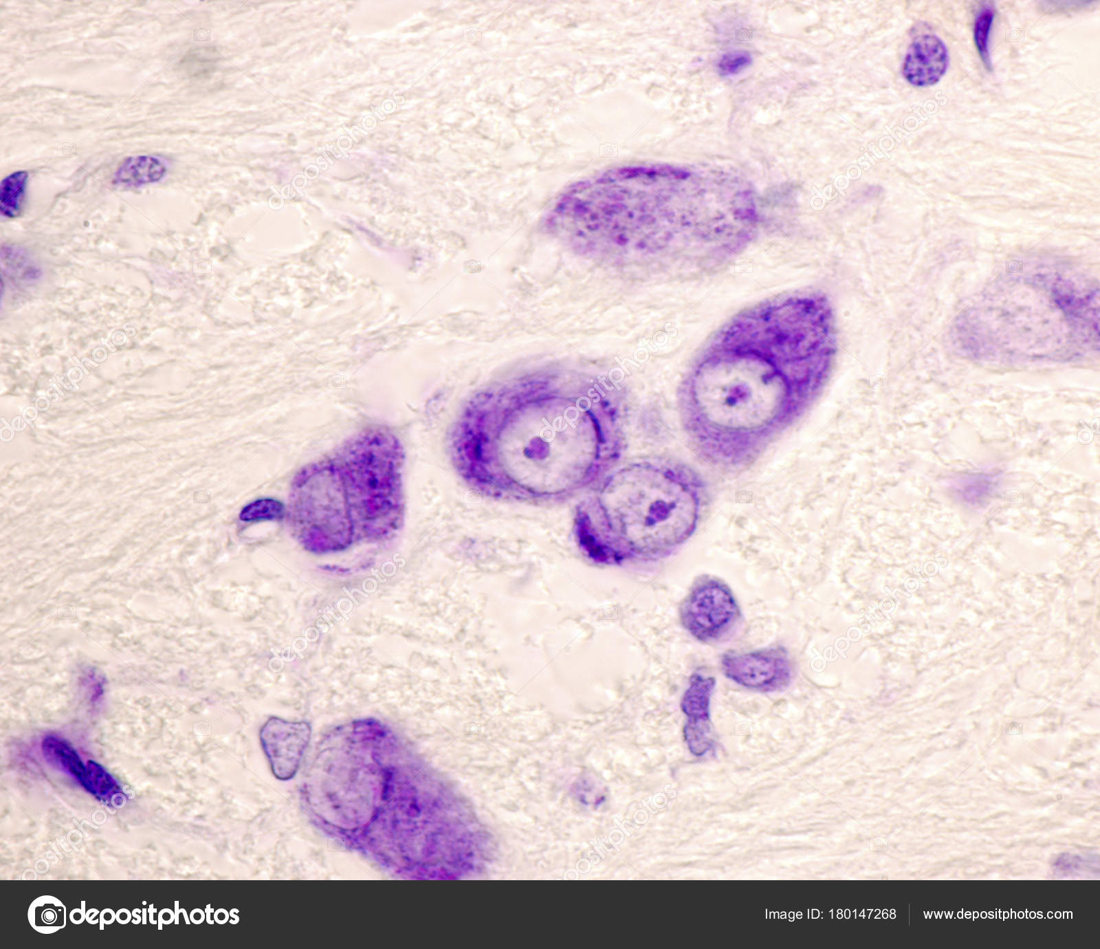 Barr body. Neuron Stock Photo by ©jlcalvo@ucm.es 180147268