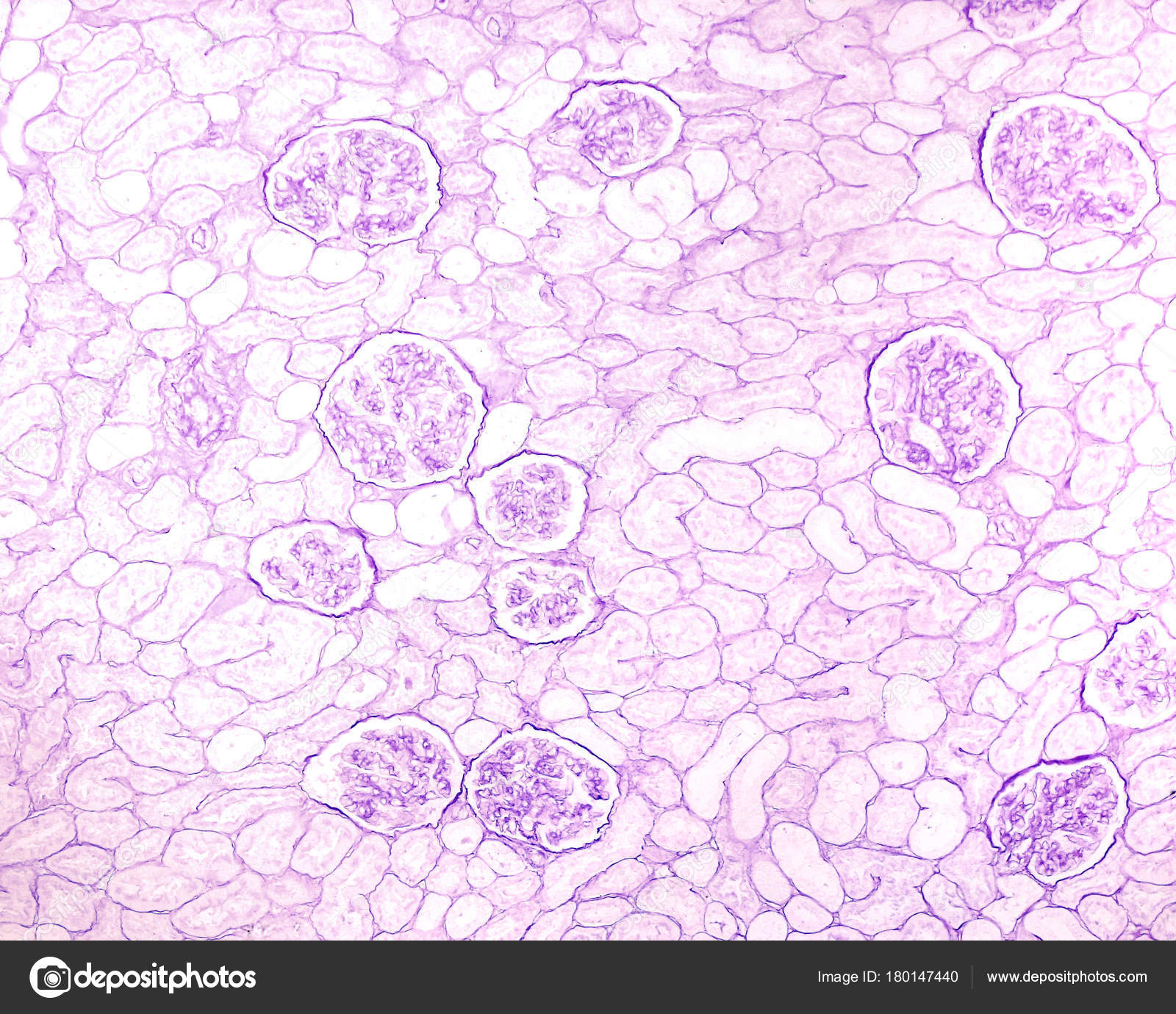Kidney. PAS Stock Photo by ©jlcalvo@ucm.es 180147440