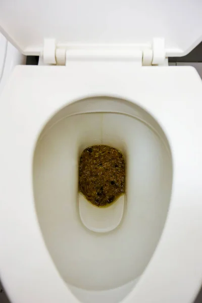 Normal Poop