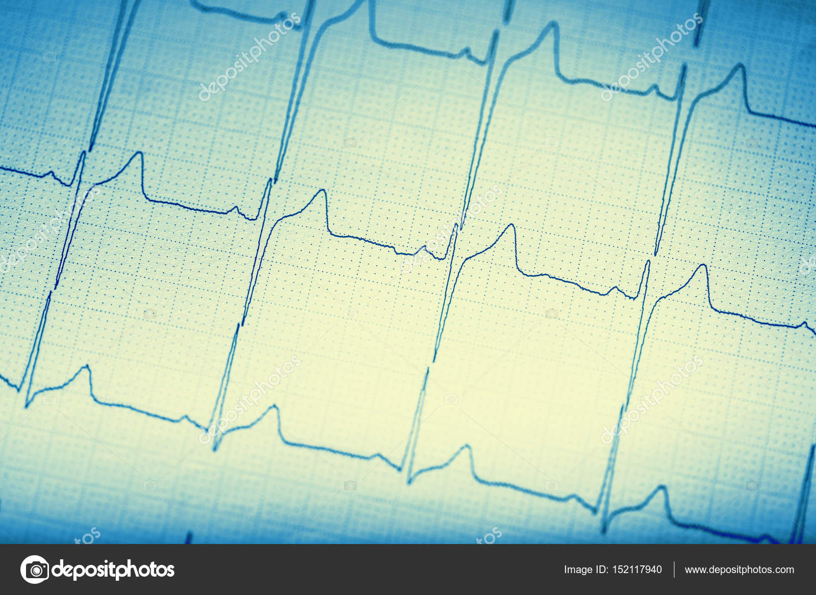 EKG graph.Electrocardiogram ekg ecg — Stock Photo © weyo #152117940