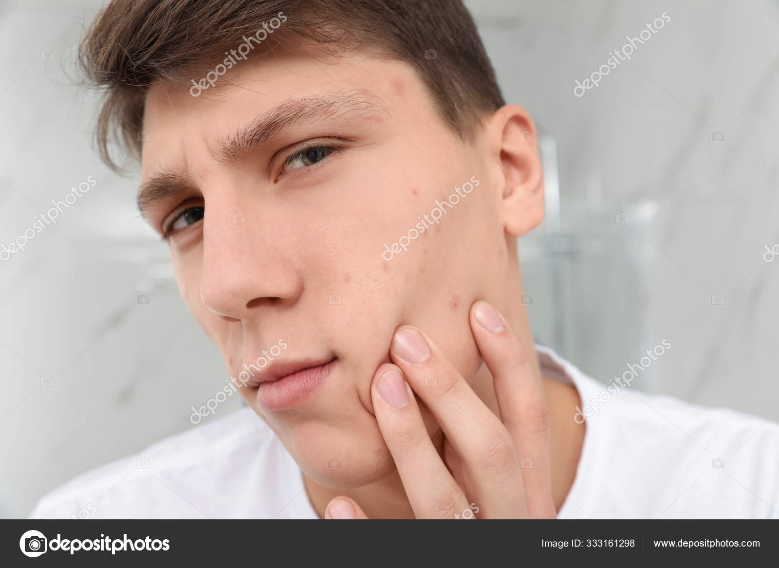 Teen guy with acne problem indoors, closeup Stock Photo by ©NewAfrica ...