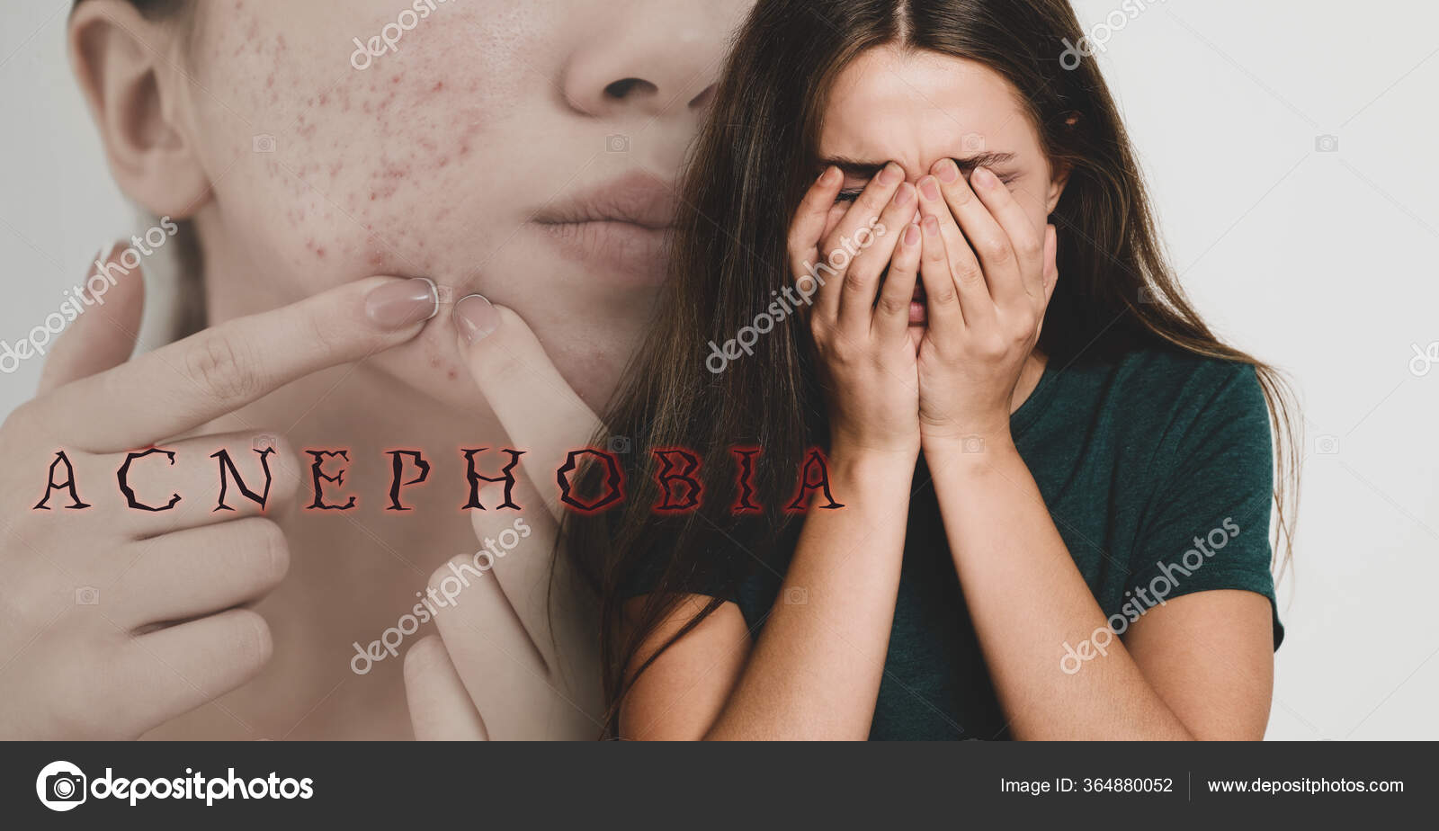 Scared Woman Suffering Acnephobia Vision Girl Squeezing Pimples Stock ...