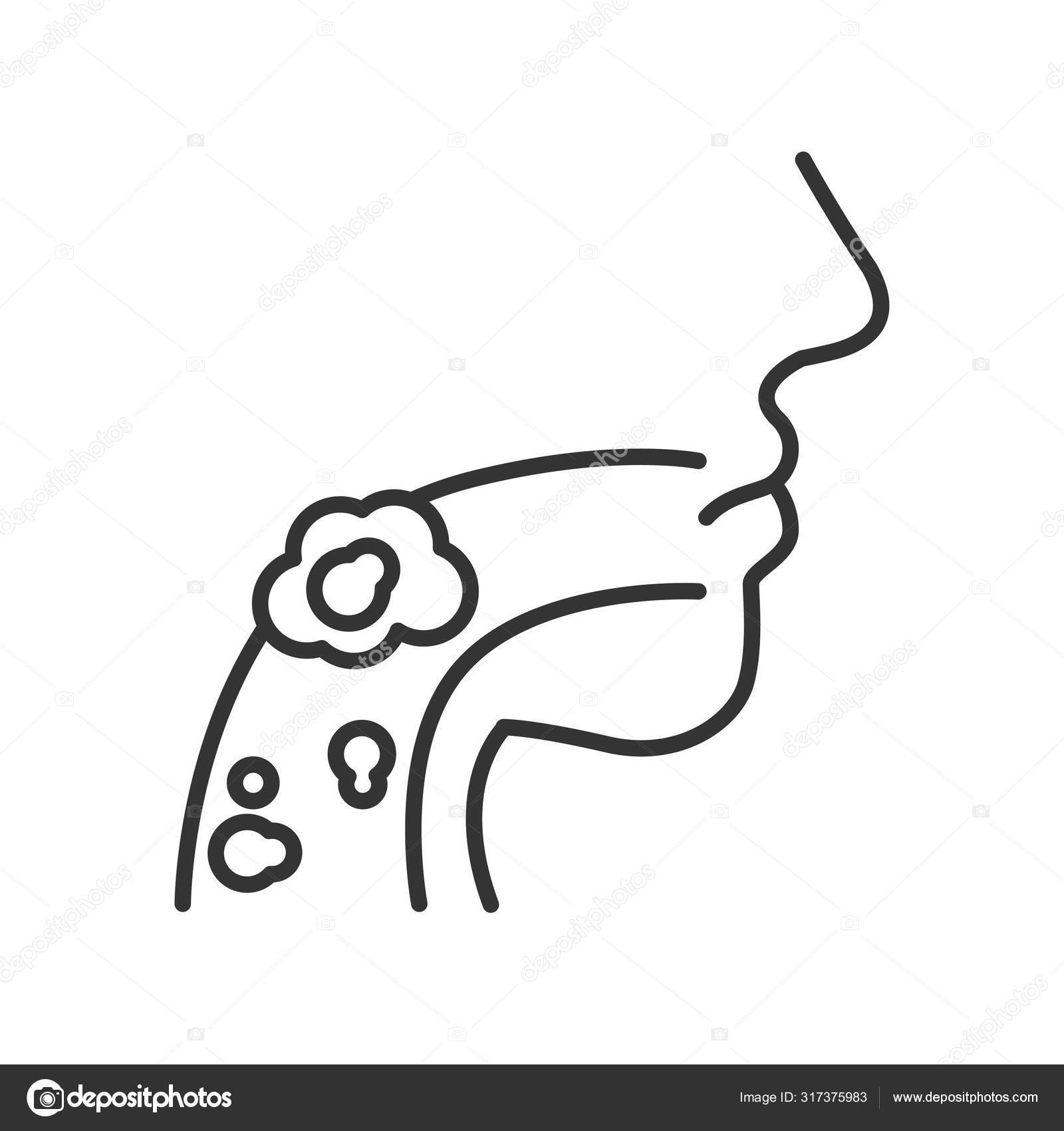 Laryngeal cancer line black icon. Human organ concept. Malignant ...