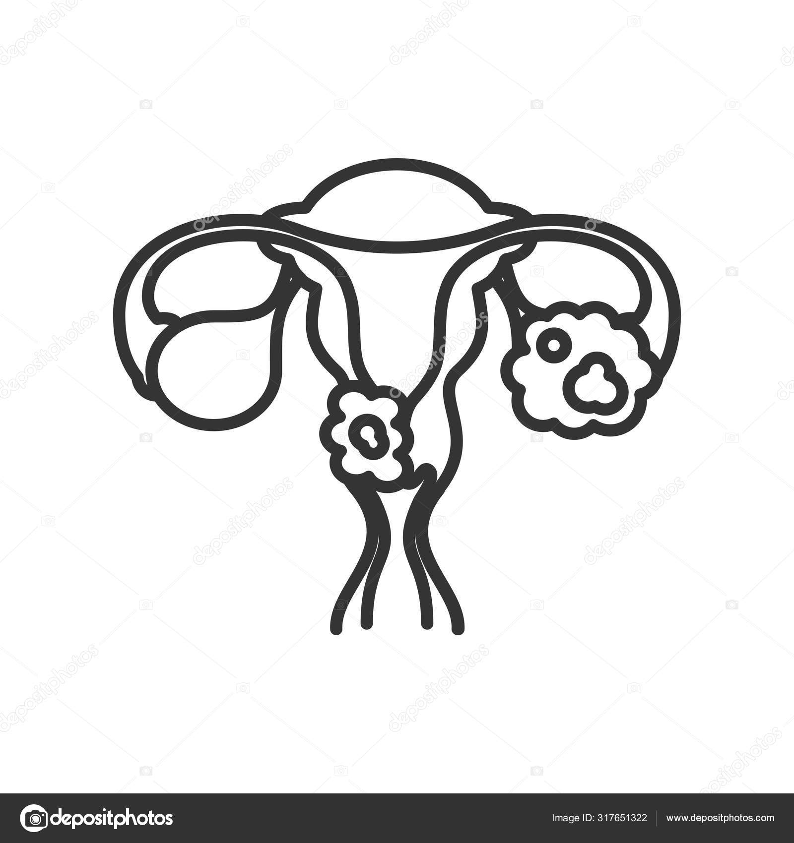 Cervical Cancer Line Black Icon Female Reproductive System Disease