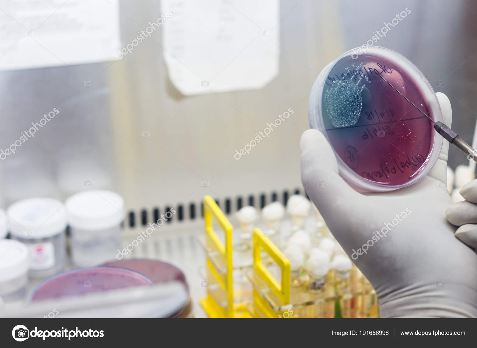 Inoculation on blood agar on a culture plate using inoculation loop by ...
