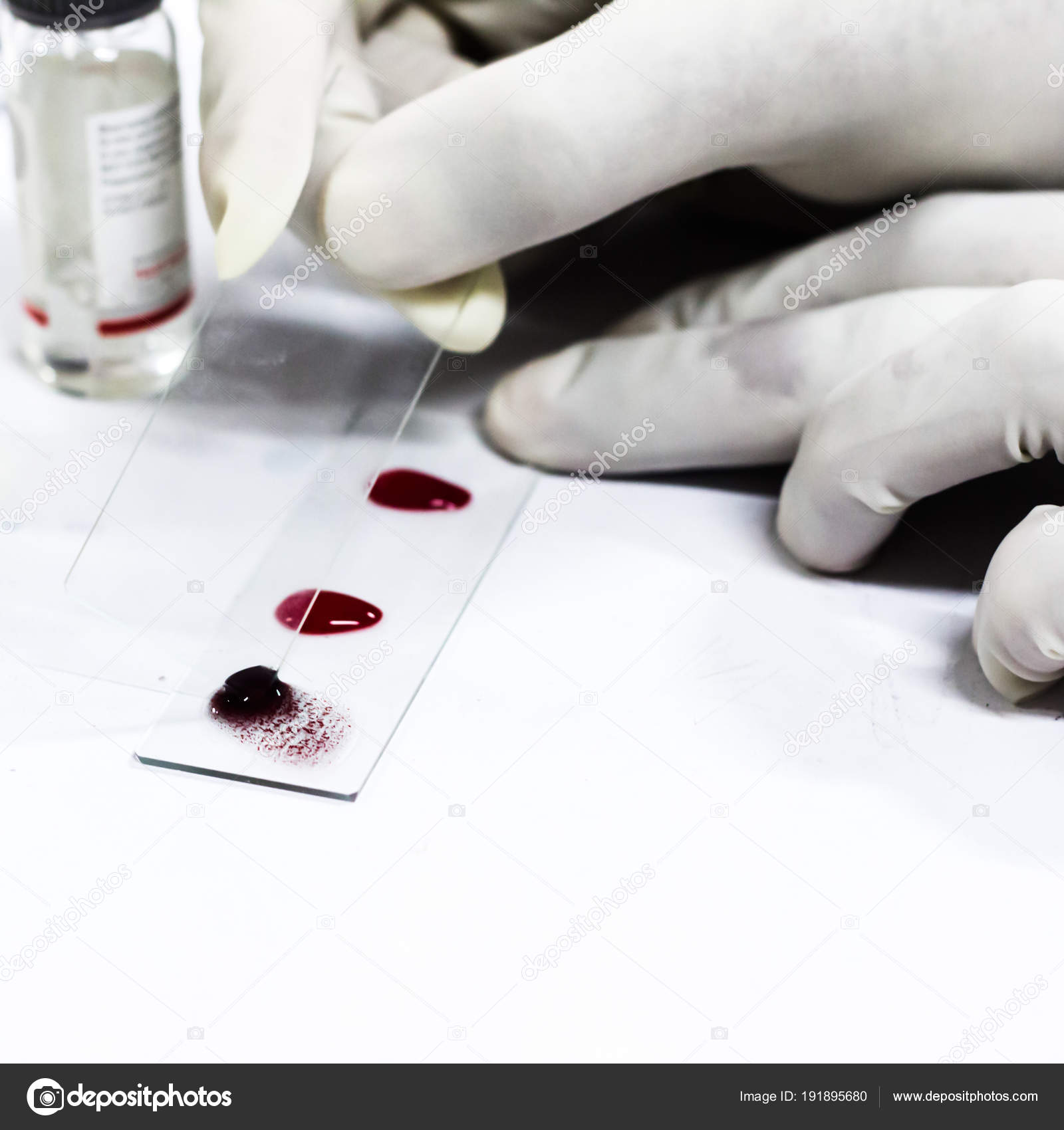 Blood grouping by slide aggutination with a glass slide — Stock Photo ...
