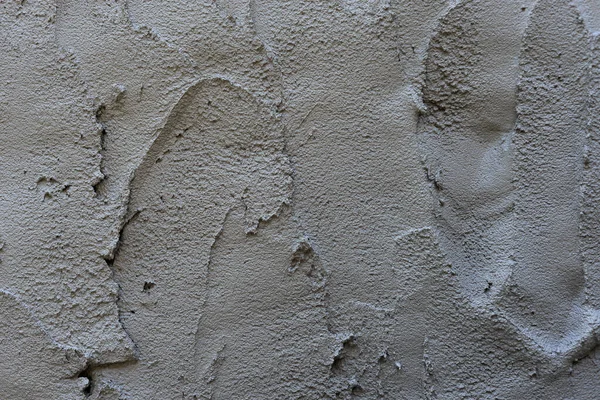 Pies de yeso fotos de stock, imágenes de Pies de yeso sin royalties ...