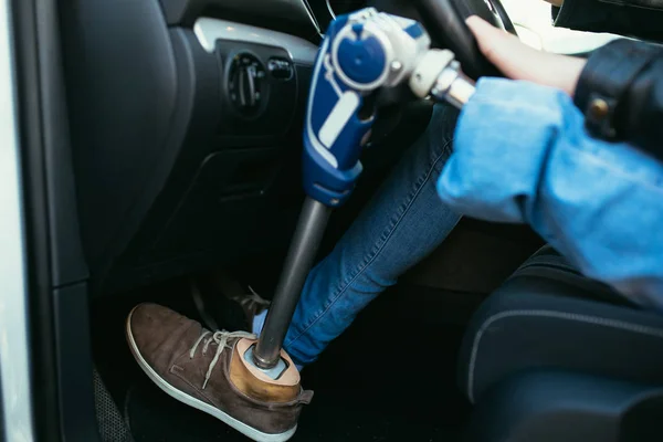 Young Man Prosthetic Leg Driving Car — Stock Photo © nenadovicphoto ...