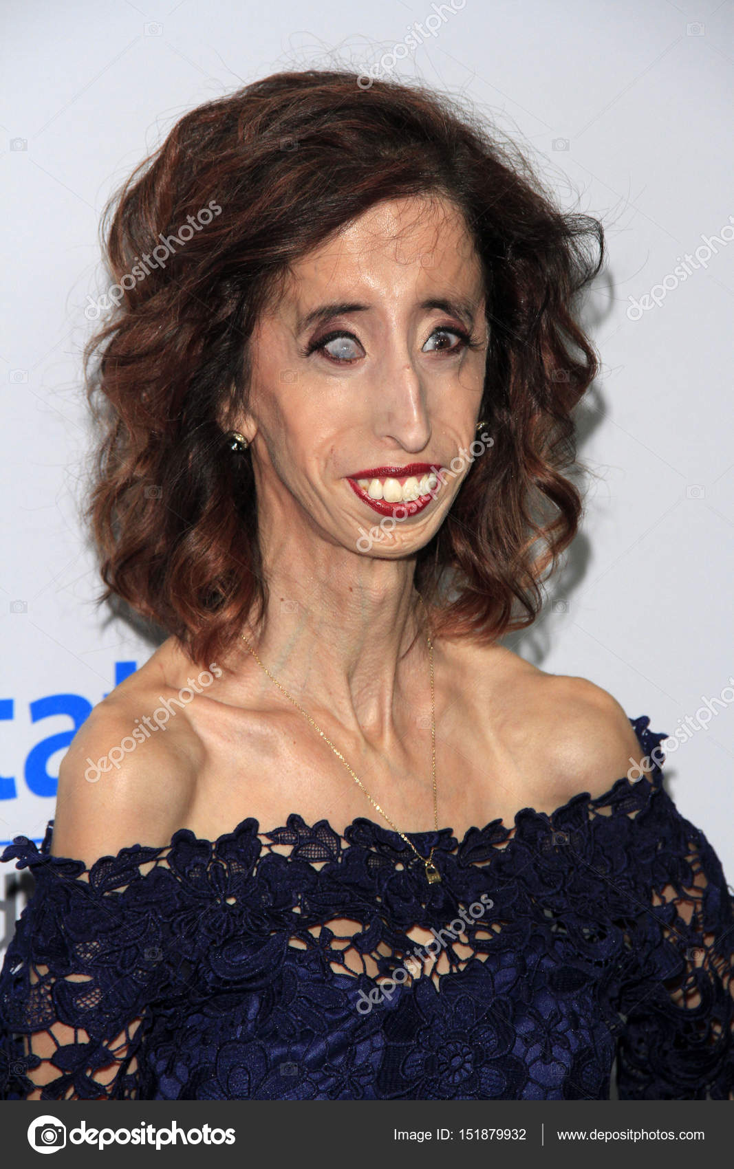 Lizzie Velasquez Pretty