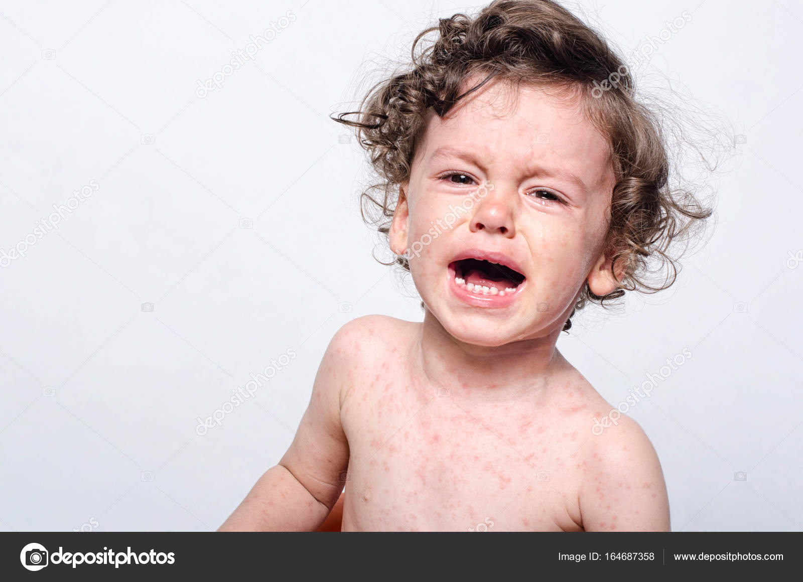 Portrait of a cute sick baby boy crying. — Stock Photo © luanateutzi ...