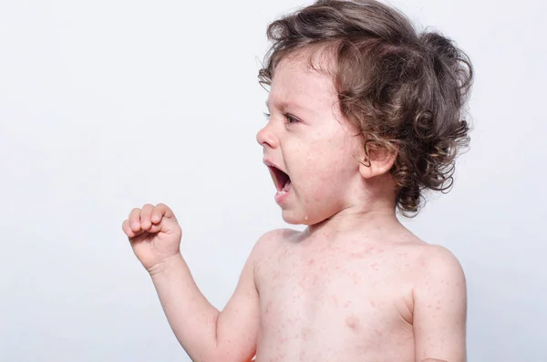 Portrait of a cute sick baby boy upset. Stock Photo by ©luanateutzi ...