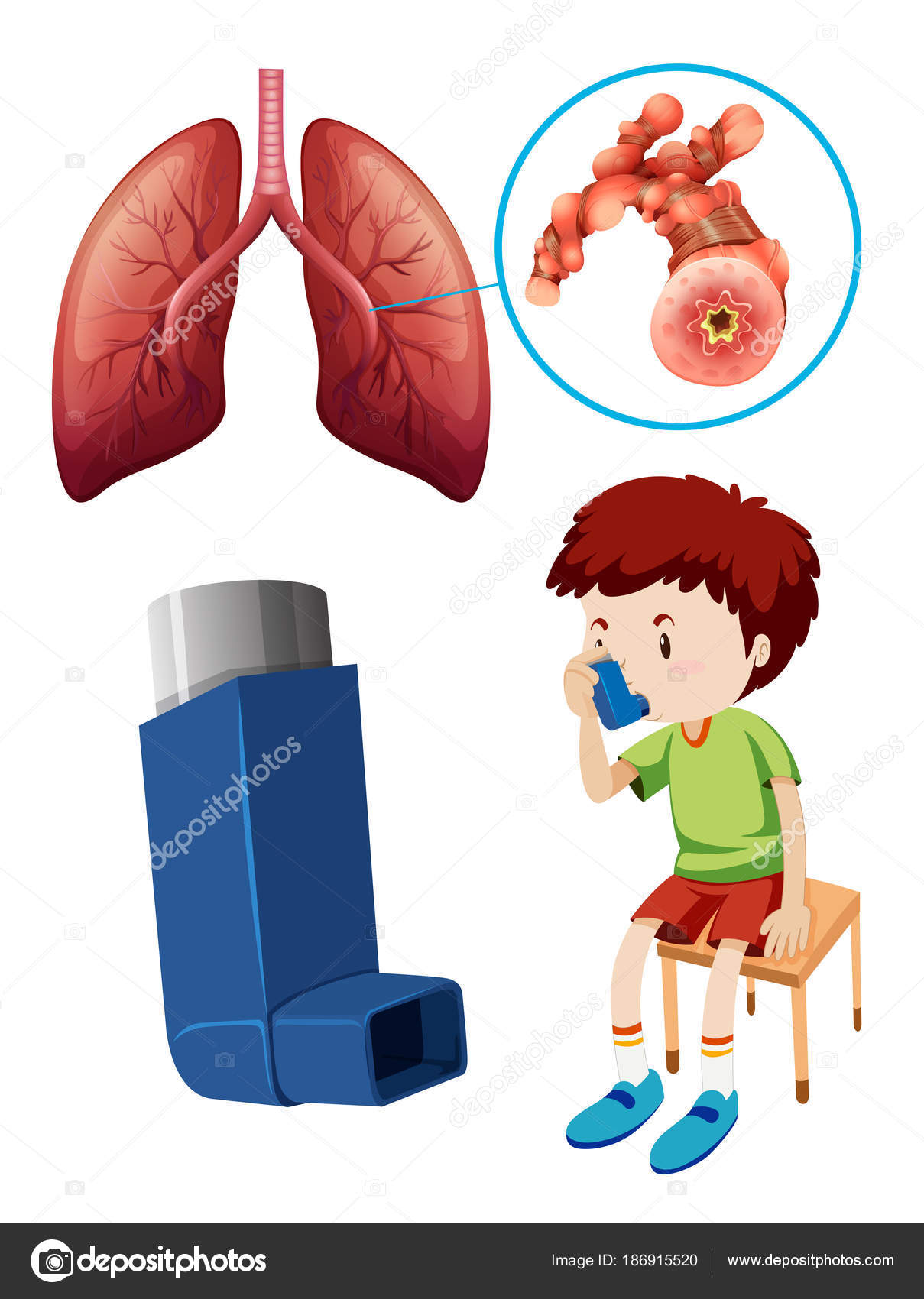 Niño con pulmones malsanos Vector de stock #186915520 de ©blueringmedia